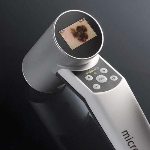 Mole mapping - van der Walt Dermatology